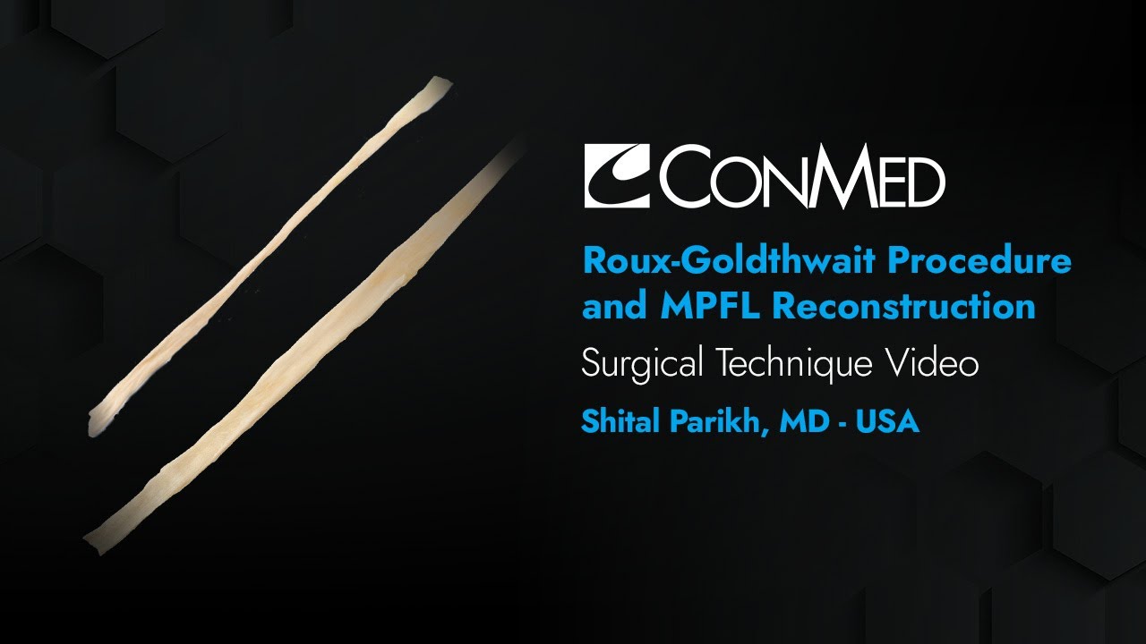Dr. Shital Parikh - Roux-Goldthwait Procedure and MPFL Reconstruction ...