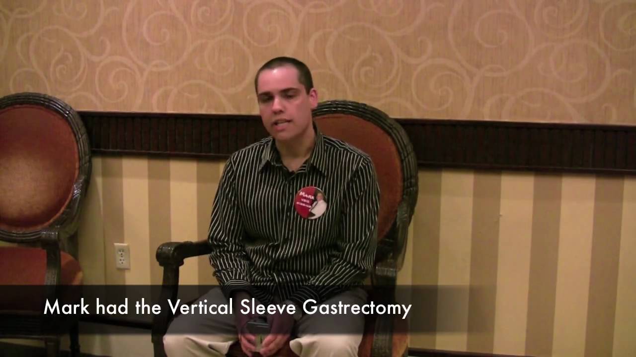 Vertical Sleeve Gastrectomy (VSG) Before and After - YouTube