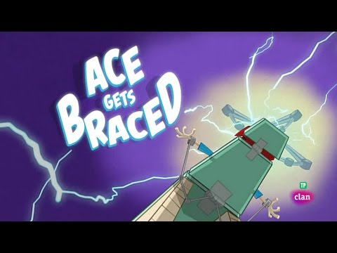 Get Ace: Ace gets braced - YouTube