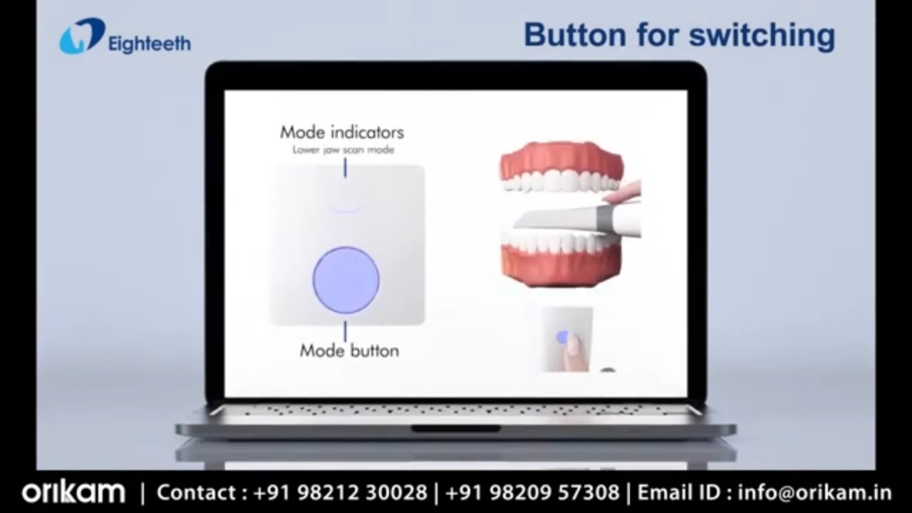 Helios 600 | Intraoral 3d Scanner | Your ideal IOS, Helios 600 | Hello ...
