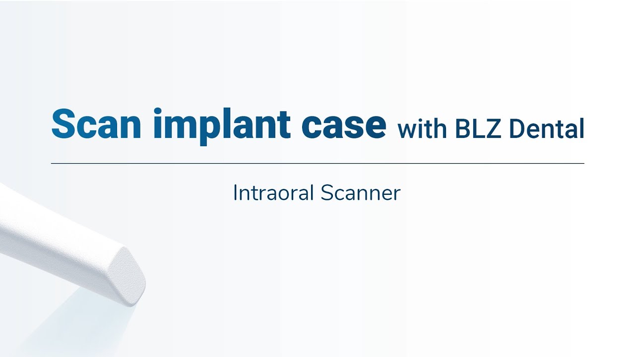 Scan Implant Case with BLZ Dental Intraoral Scanner - YouTube
