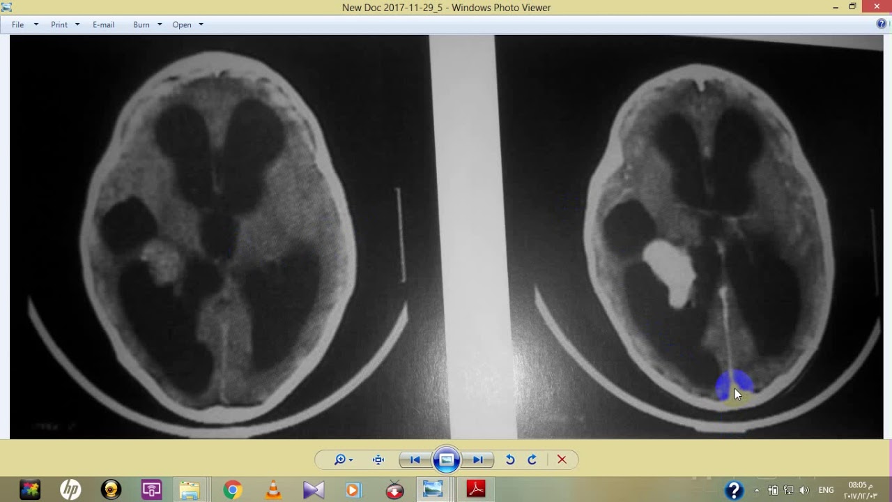 PEDIATRICS CT 2017 - YouTube