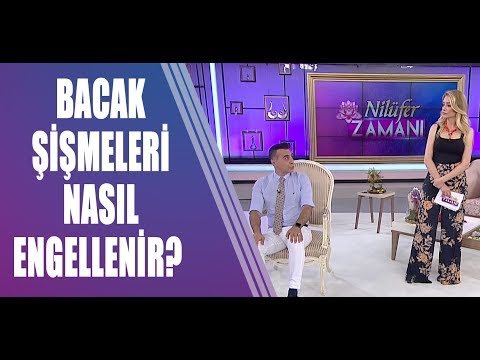 Uzun yolda bacak şişmeleri nasıl engellenir?
