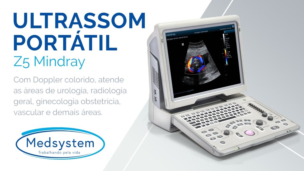 Ultrassom Z5 Mindray - YouTube