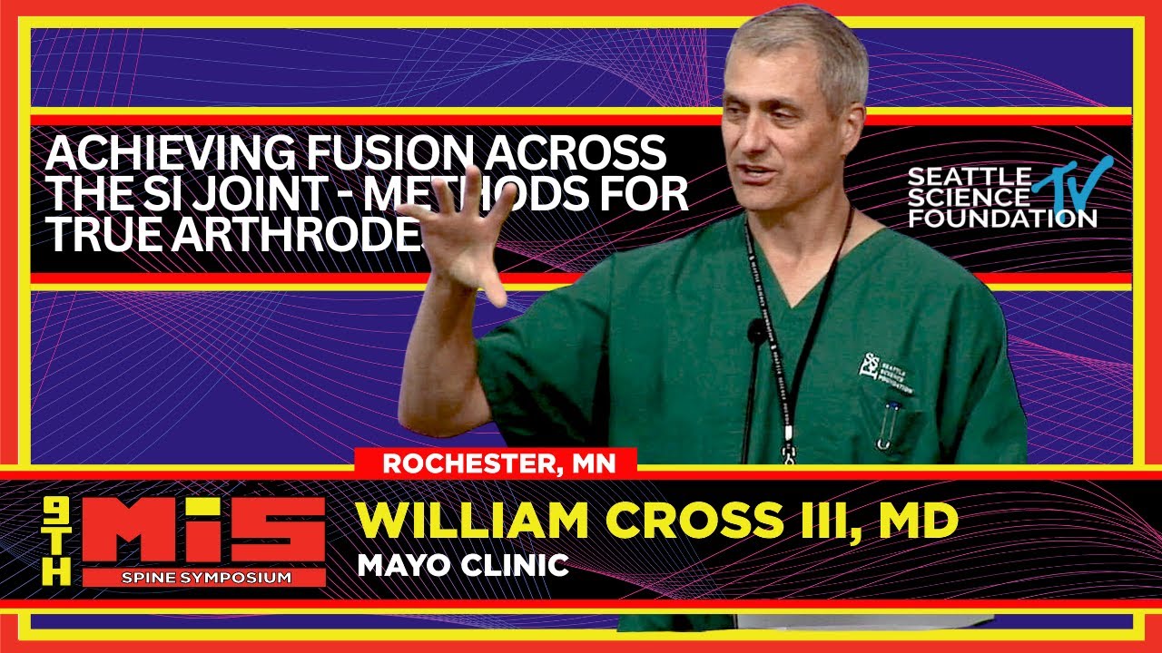 Achieving Fusion Across the SI Joint Methods for True Arthrodesis - William Cross, M.D. - YouTube