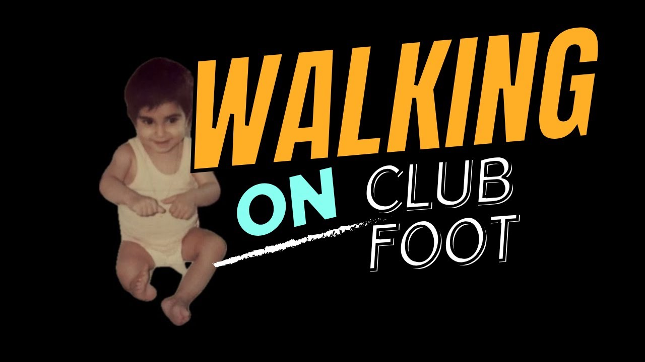 Life with Club Foot: My Journey before Amputation - YouTube