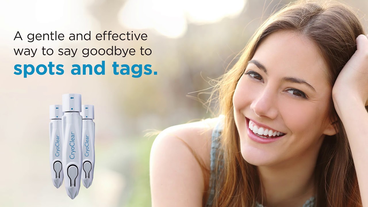 CryoClear® Pen | The fast and gentle way to painlessly treat age spots ...