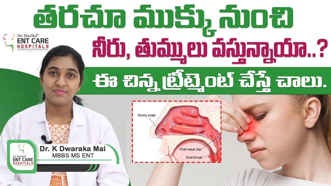 Treatment For Allergic Rhinitis || Allergic Rhinitis Cure || Dr Harika ...