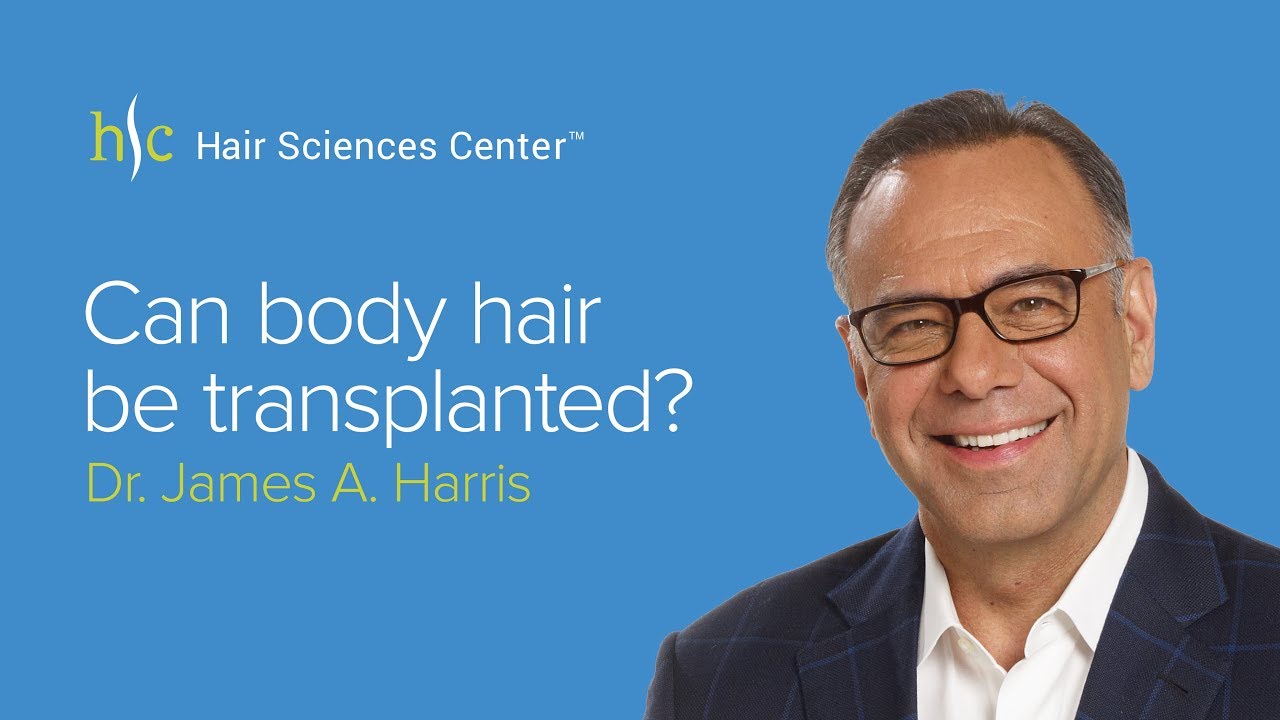 Body Hair Transplant | Hair Sciences Center | Dr. James Harris - YouTube
