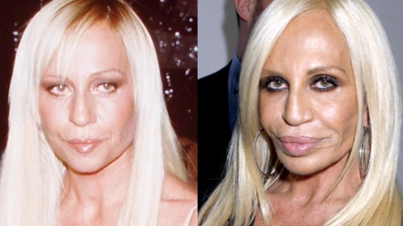 Shocking Plastic Surgery Fails Compilation - YouTube