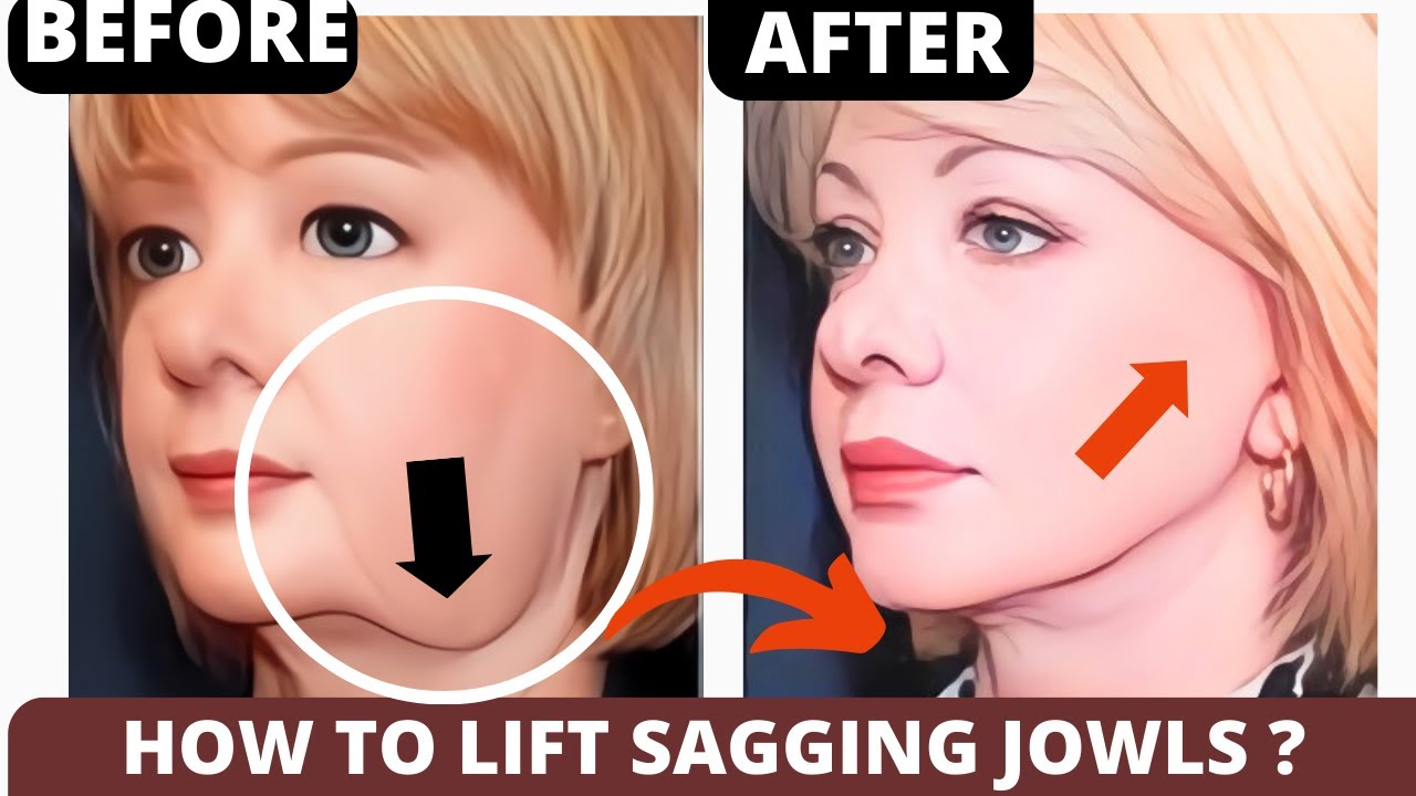 FACIAL EXERCISES TO TONE JOWLS & SAGGY SKIN !| FACE EXERCISES FOR ...