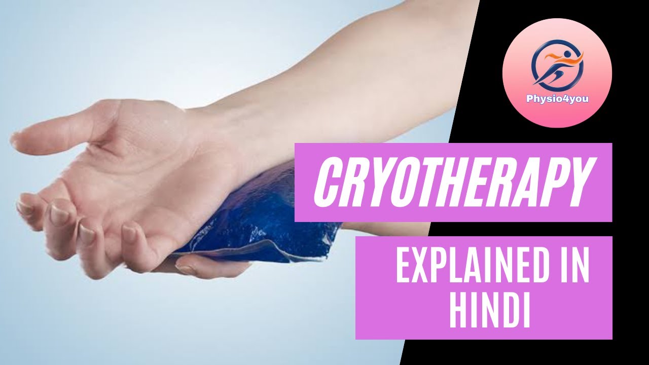 Cryotherapy ll Explained in hindi ll Electrotherapy - YouTube