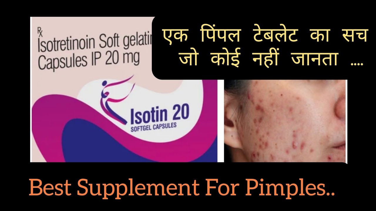 Only One Month Course Pimple's Gone| Isotretinoin Tablets|Uses& Side ...