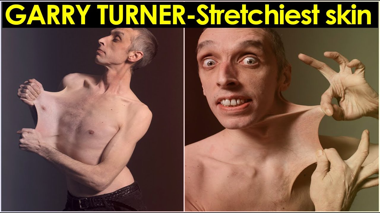 Garry Turner- Stretchiest skin Guinness World Records | Thinking - YouTube