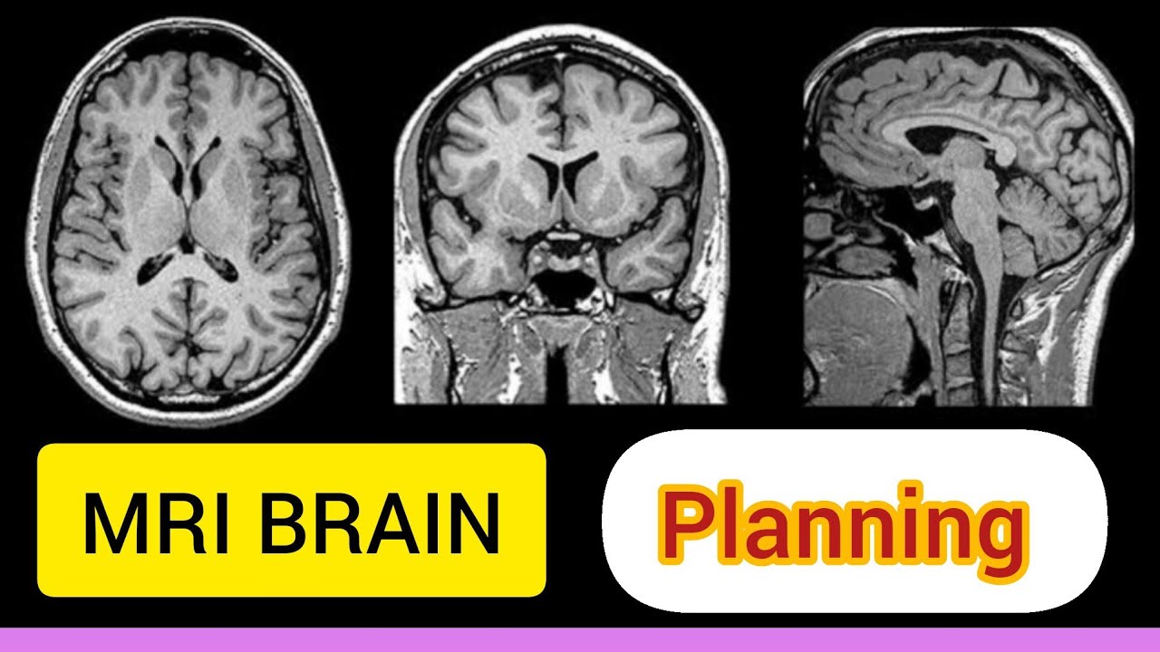 MRI BRAIN PLANNING EXPLAINED | SIEMENS MRI | - YouTube