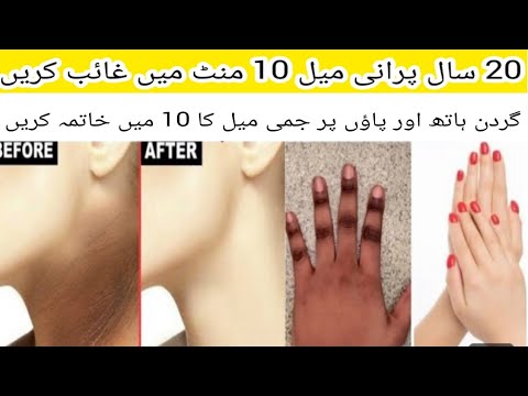 Neck tanning removel home remedy| neck whiting remedy by Amna ka ...
