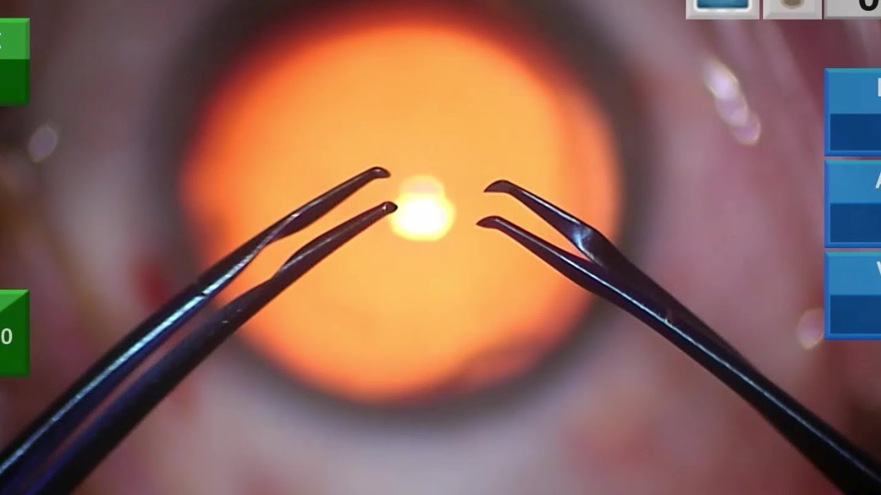 SIR Series Episode #5: EPSILON ERF-31S Sharp Tip Haldipurkar ...