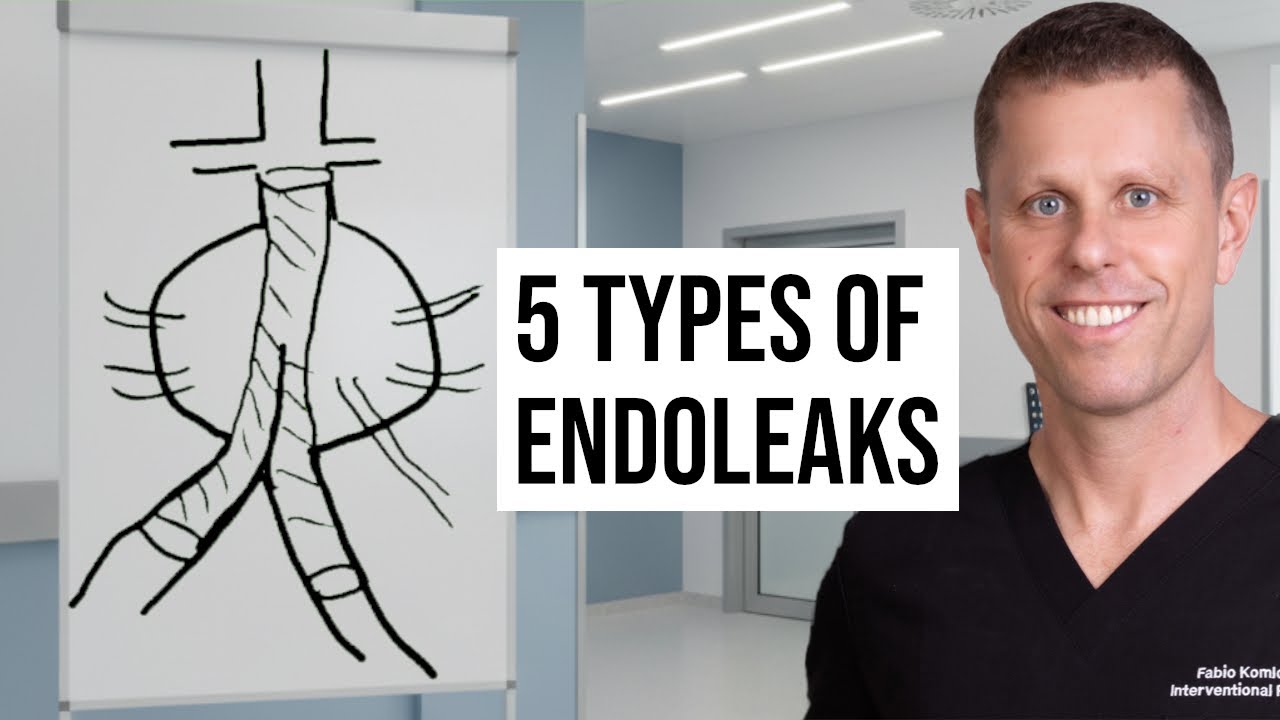 Endoleaks Explained: A Guide for Patients and Doctors - YouTube