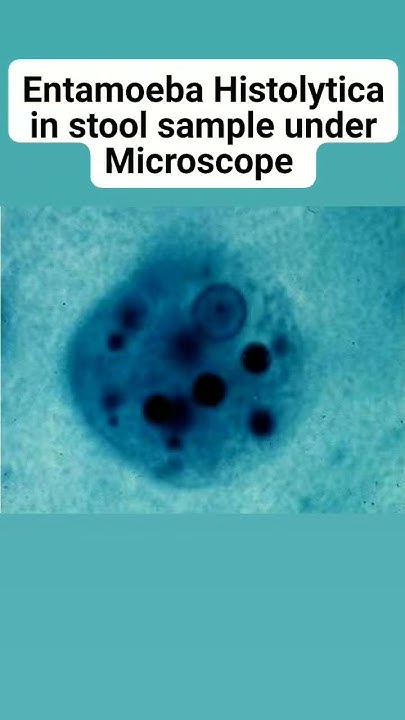 Entamoeba Histolytica in stool sample under Microscope. - YouTube