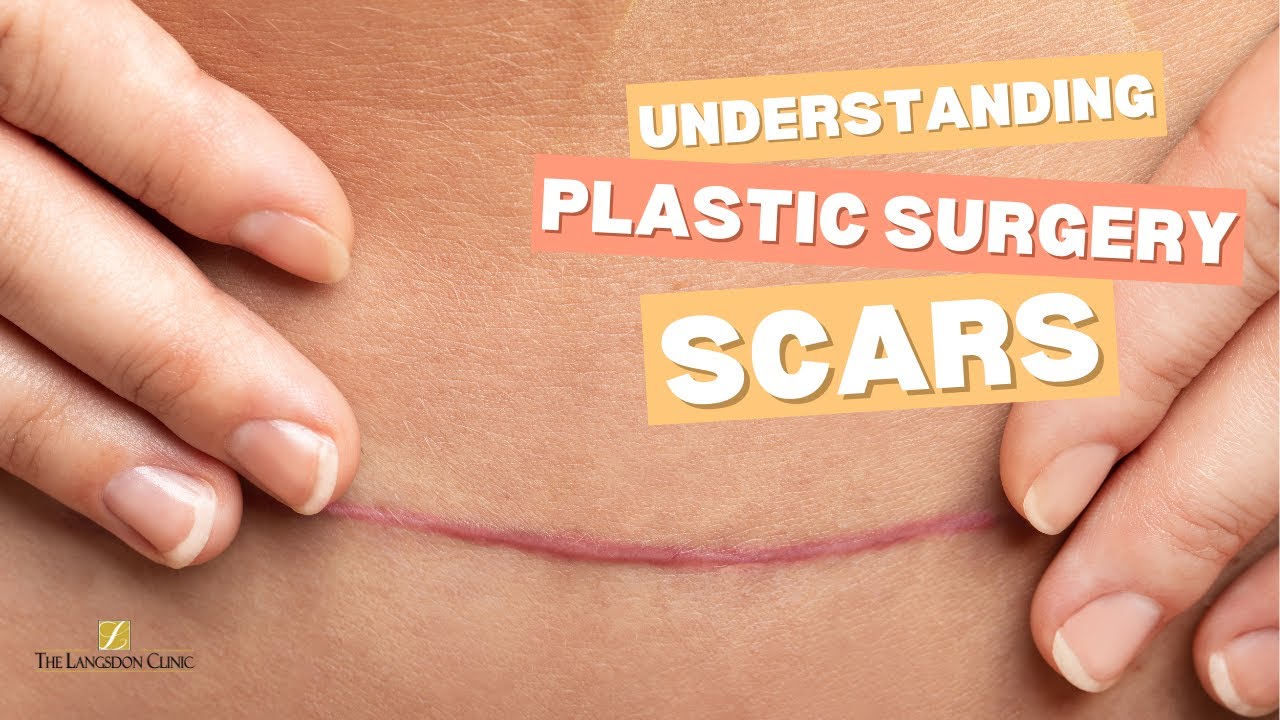 Top Plastic Surgeon Reveals Secrets to Minimizing SCARS - YouTube