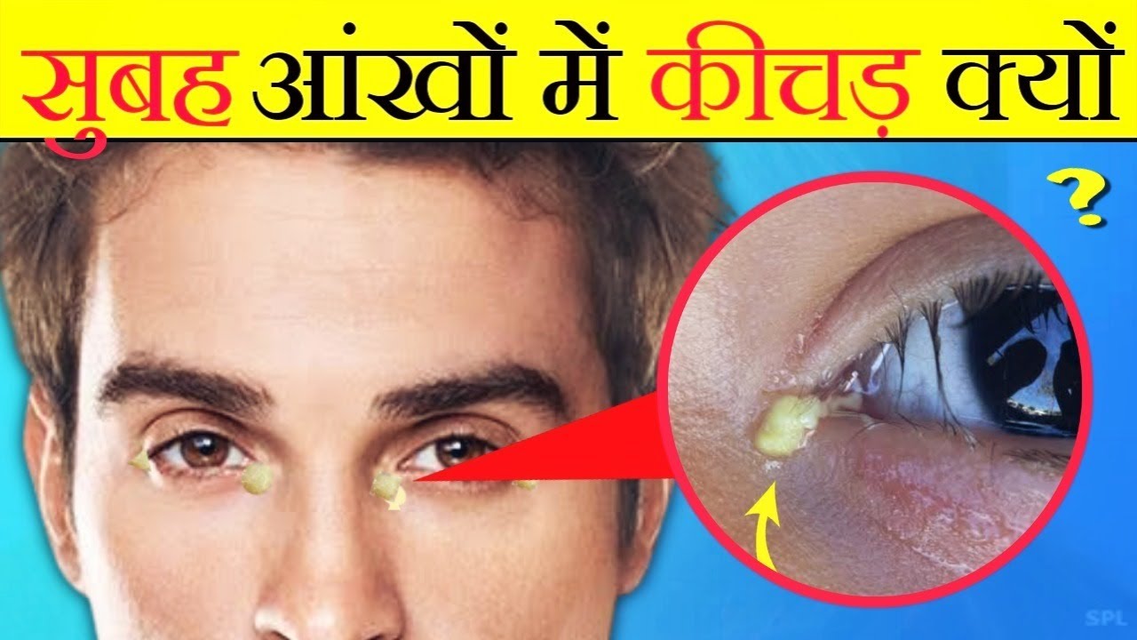 सुबह आंखो में KICHAD क्यों ? | Why eye mud occurs in morning ? | Fact 🌍 ...
