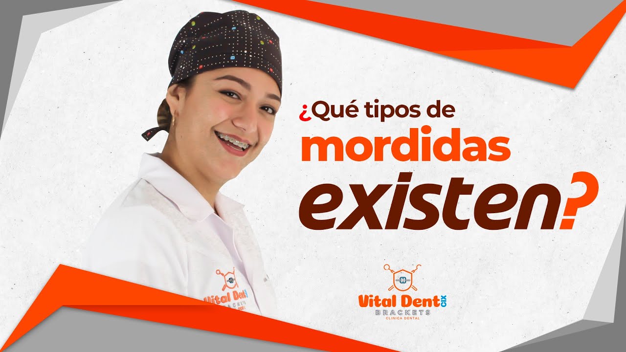 ⭕ TIPOS DE MORDIDAS 👍 - YouTube