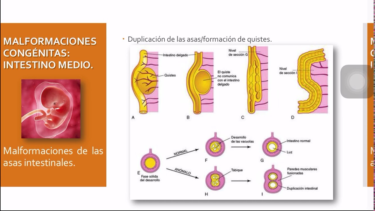 DESARROLLO EMBRIONARIO DEL APARATO DIGESTIVO | Parte III - YouTube