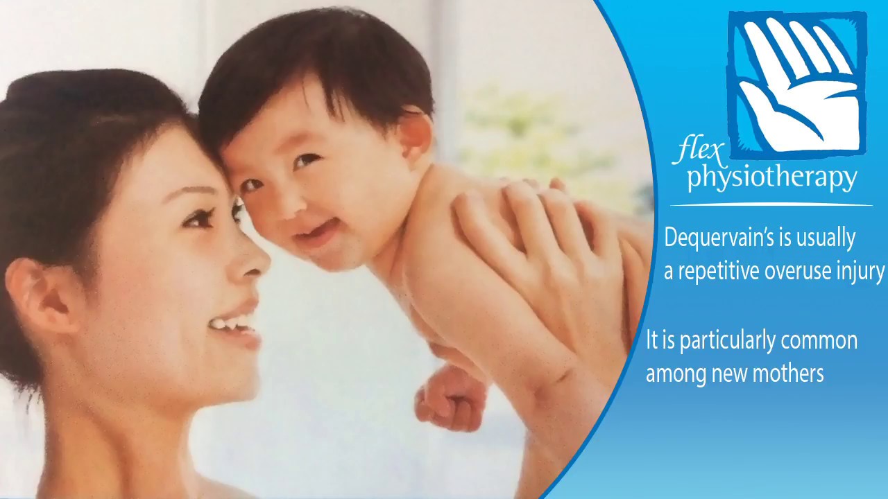 Wrist Pain in New Mothers | Dequervains Tenosynovitis - YouTube