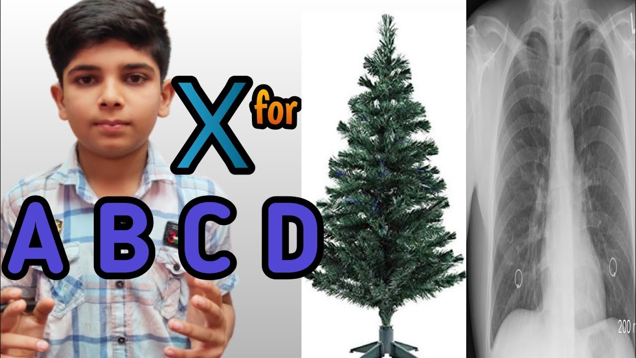 Alphabet,Xmas tree,chirstmas,Xerox, xray।abcd for kids। A to Z series ...