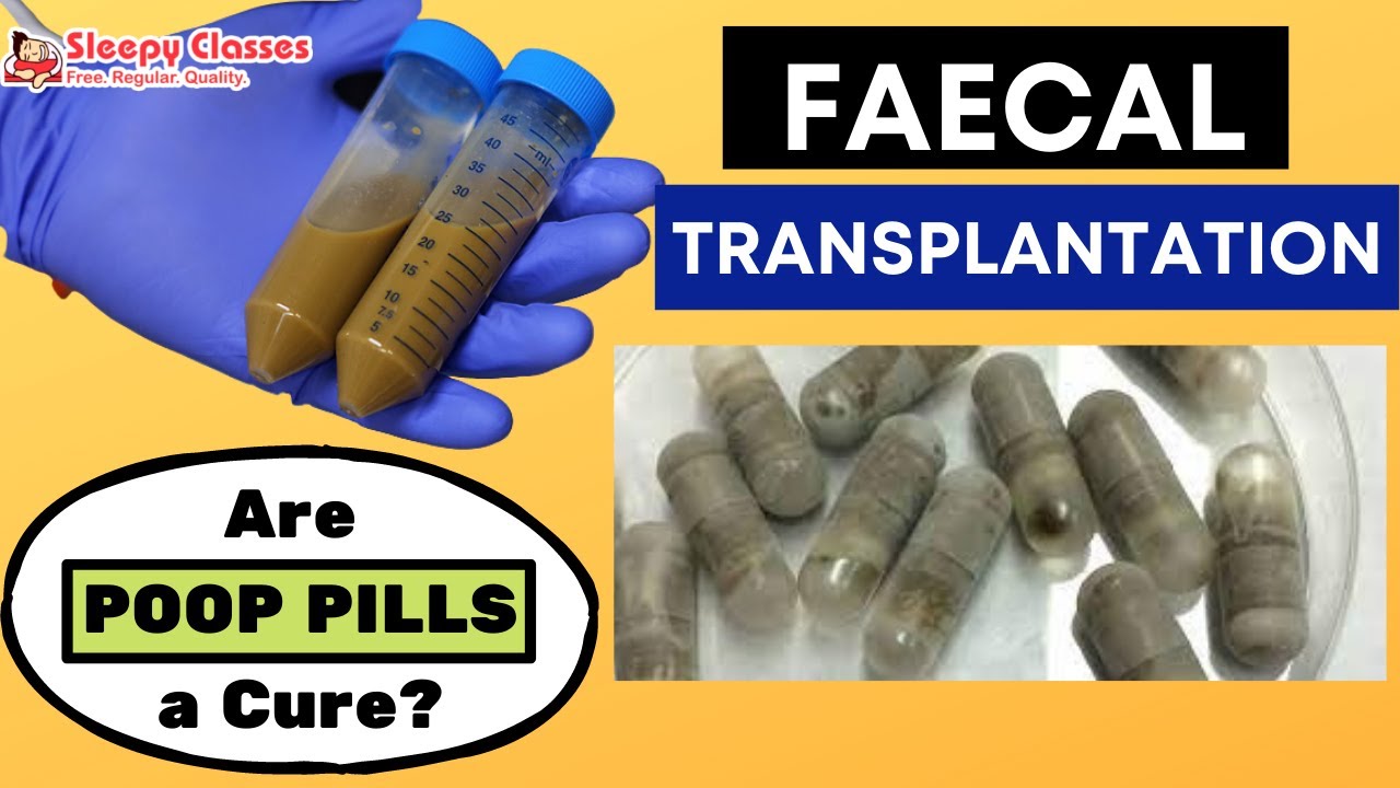 All About FAECAL TRANSPLANTATION in 5 minutes. - YouTube