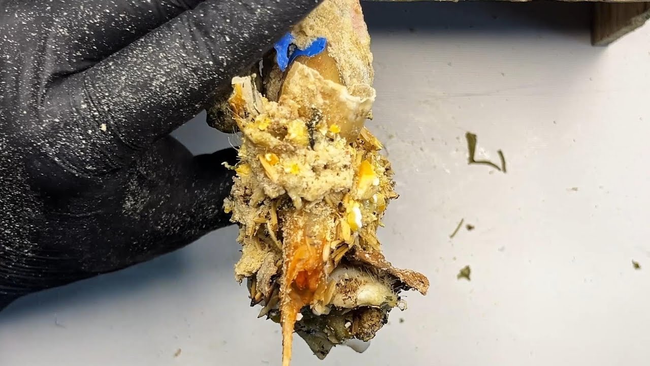 CUT Ingrown Toenails, Toenails with Maggots, Fungal Toenails ...