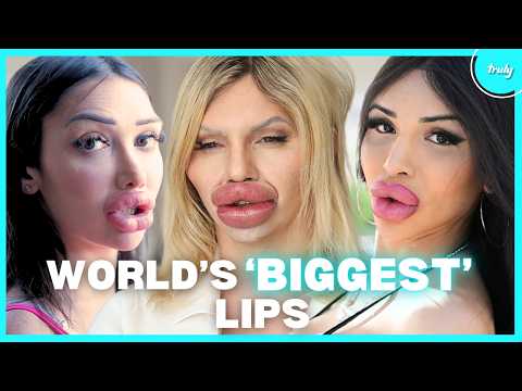We're Addicted To Lip Filler | HOOKED ON THE LOOK