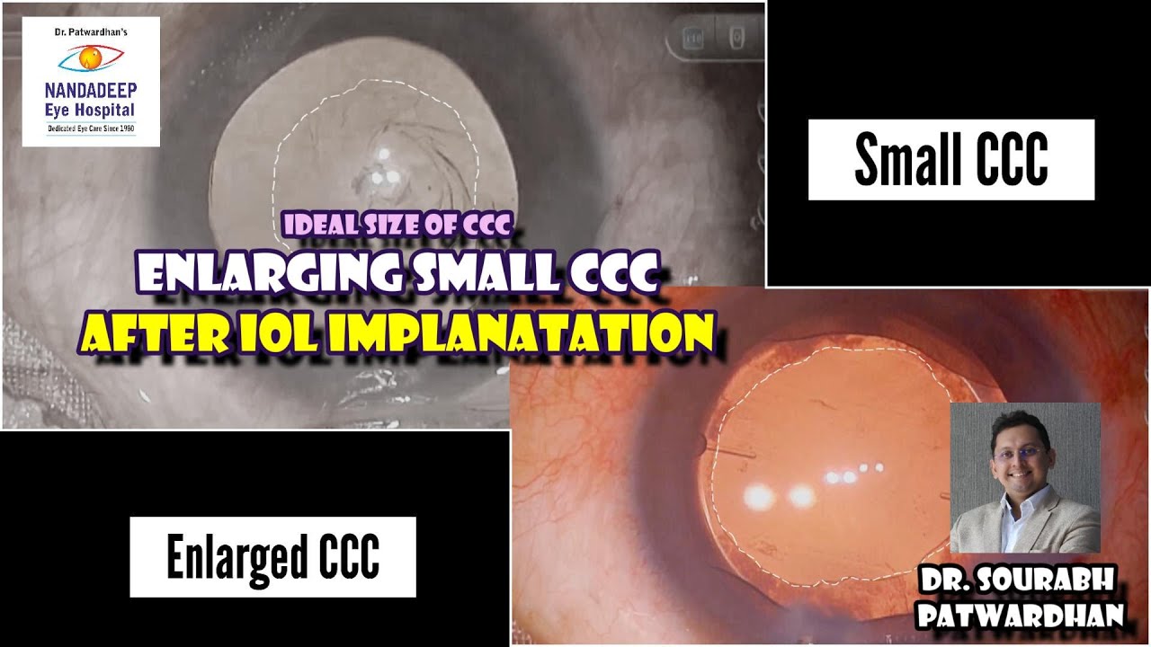 225 small CCC- no problem- enlarge it Dr Sourabh Patwardhan - YouTube