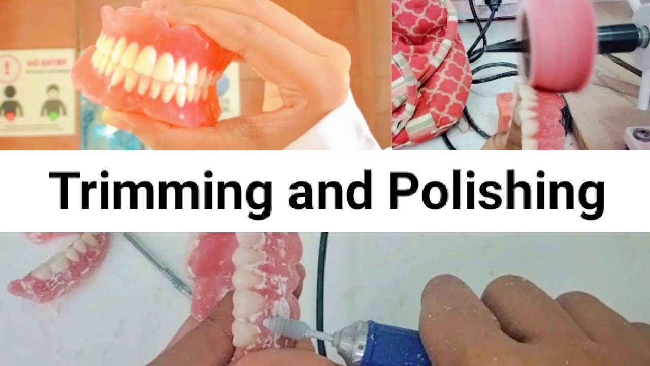 Step#17 Trimming and Polishing #complete_denture - YouTube