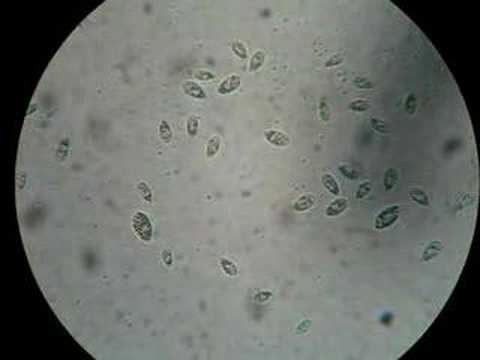 uronema - YouTube