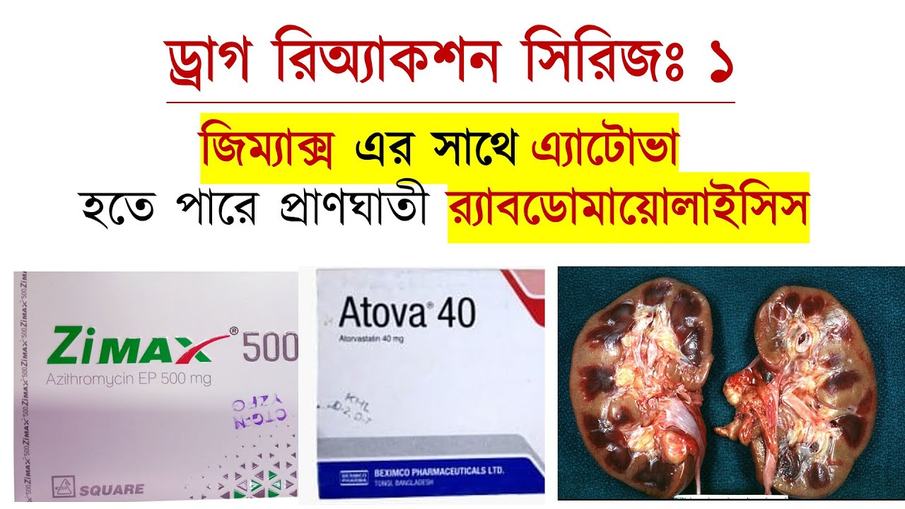 Drug reaction: Zimax + Atova (Azithromycin + Atorvastatin/Statin drugs ...