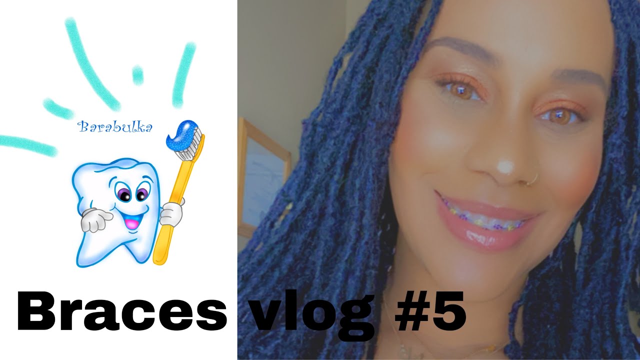Braces Vlog 5 Youtube
