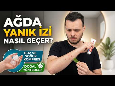 Ağda Yanık İzi Nasıl Geçer?