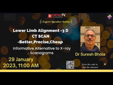 Lower Limb Alignment 3 D CT SCAN Better,Precise,Cheap Informative ...