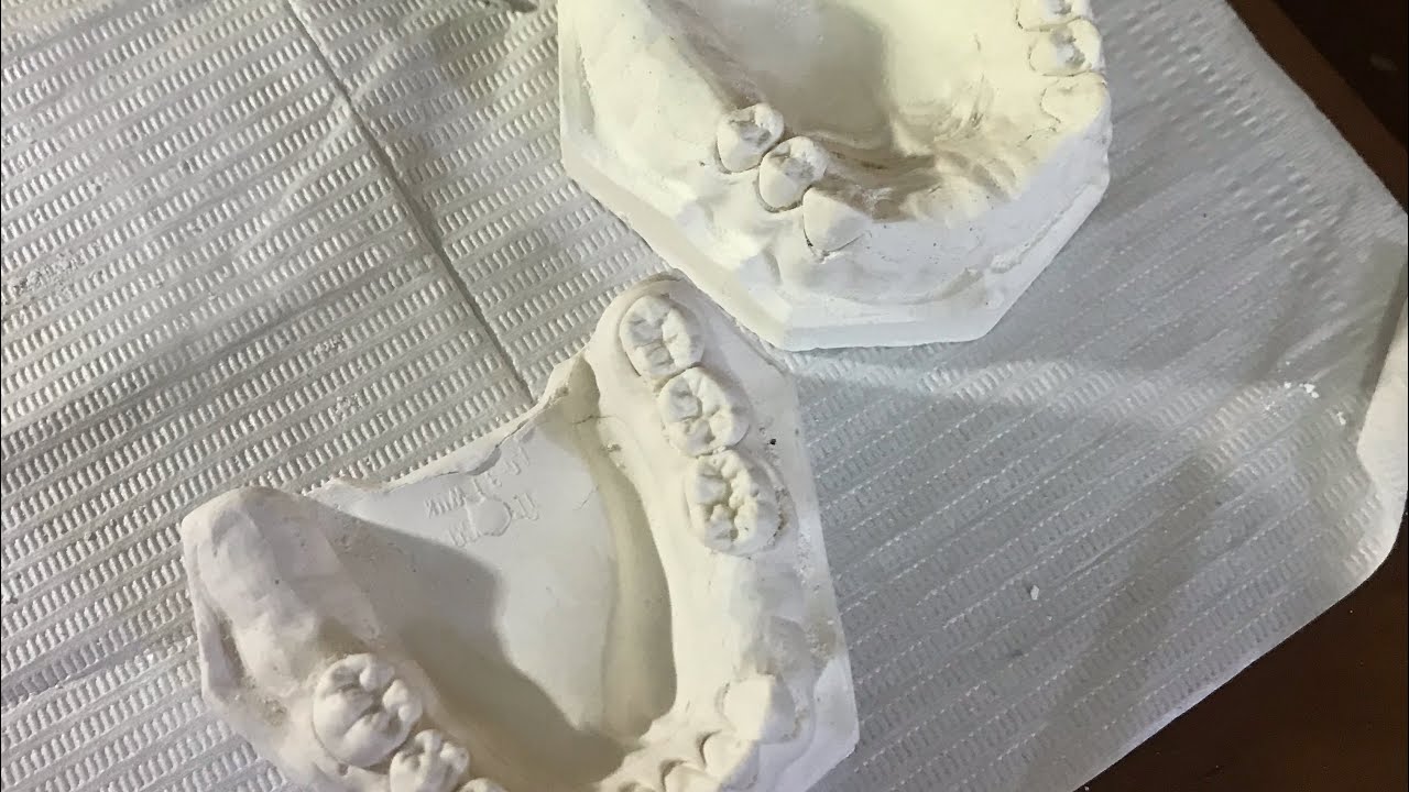 Trimming of upper cast part 3 - YouTube