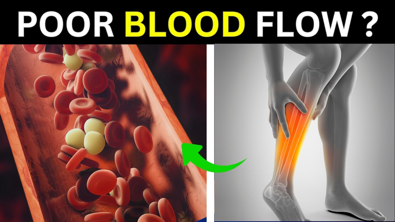 7 Warning Signs of Poor Blood Circulation You Should Never Ignore - YouTube