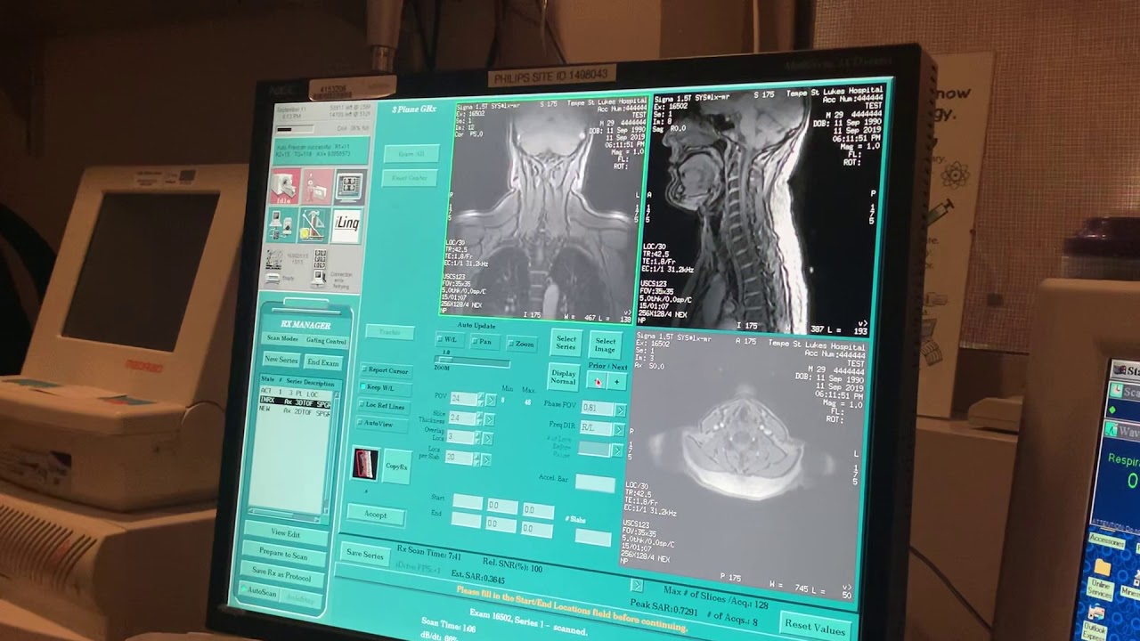 MRA Neck - Scan - YouTube