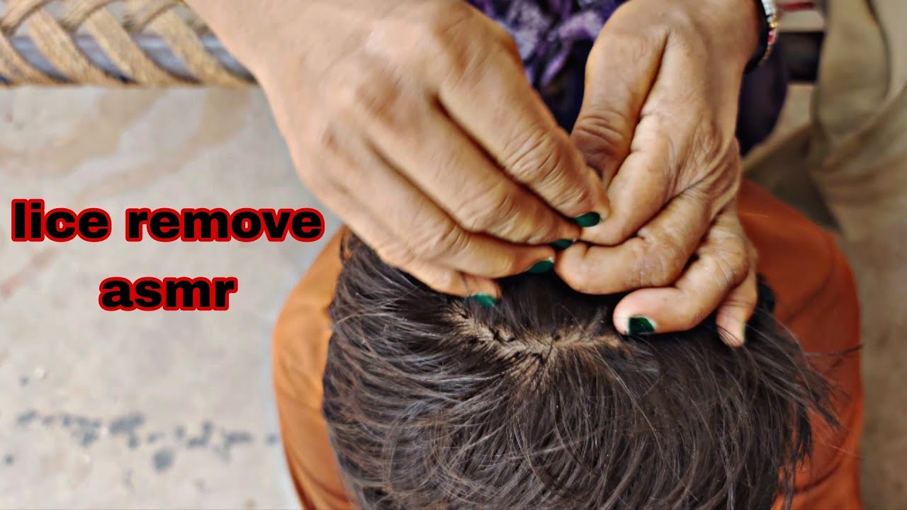 Lice check and remove lice asmr - YouTube