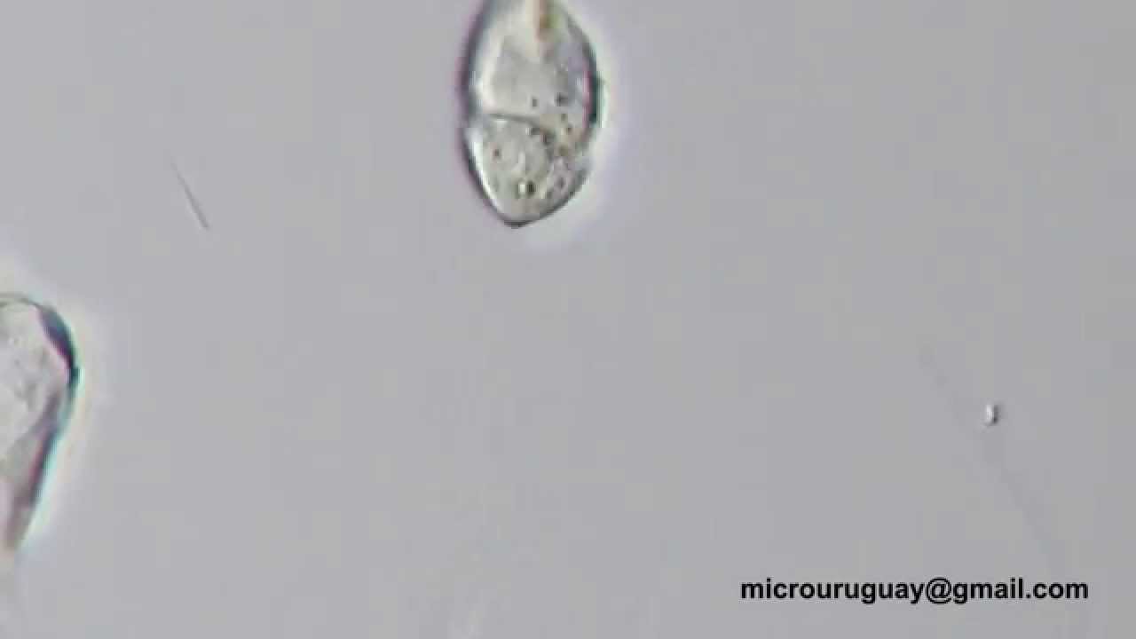Dinoflagelado Gyrodinium - Dinoflagellate Gyrodinium - YouTube