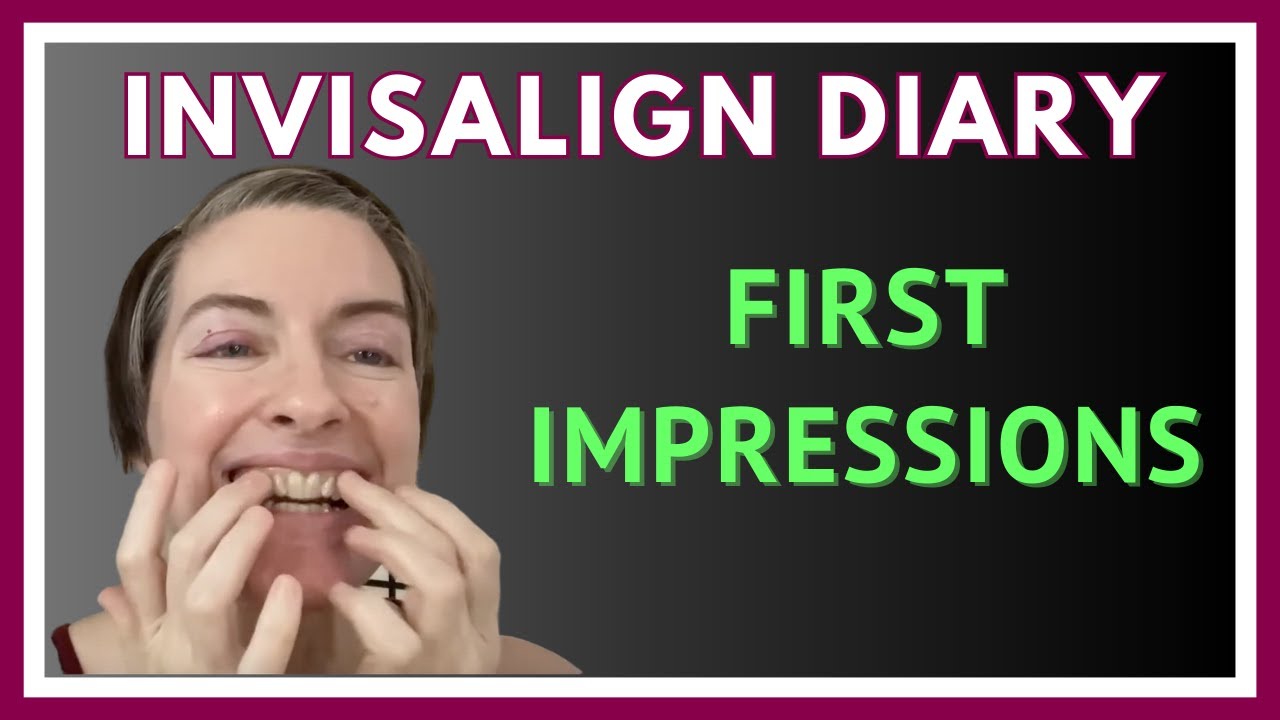 Day 1 INVISALIGN Smile DIARY | Cosmetic Dentistry Over 40 - YouTube