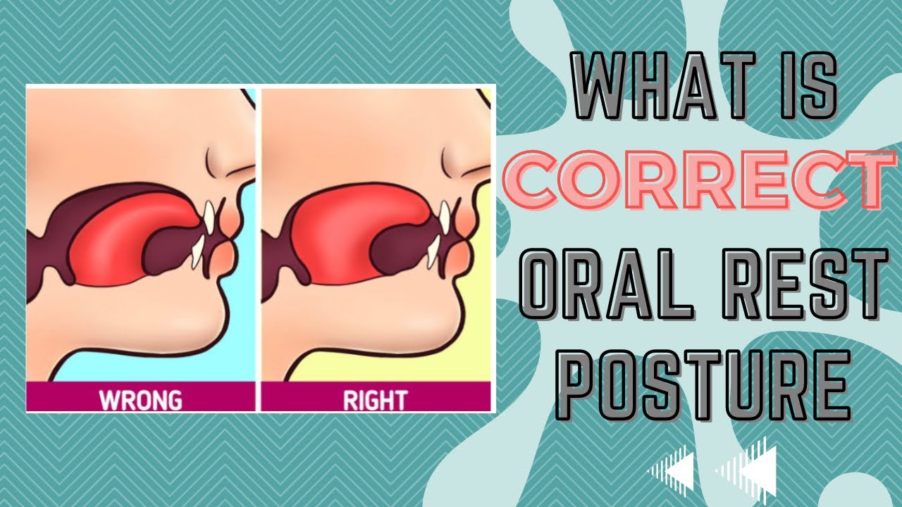 TMJ Issues? Do you know what correct oral rest posture is? - YouTube