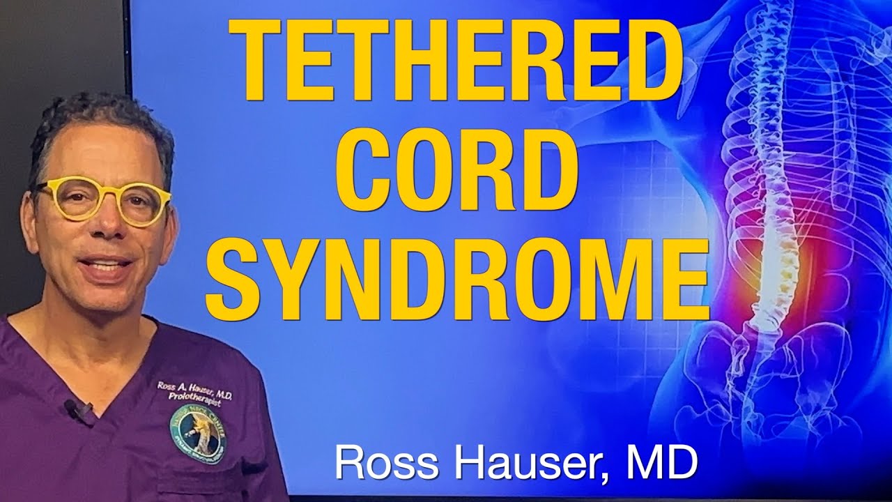Tethered cord syndrome- Is it the right diagnosis? How do non-surgical ...