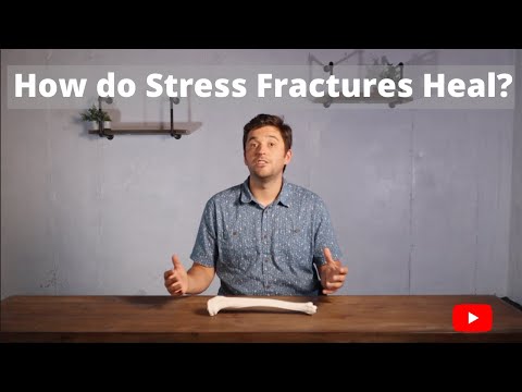 Can You Bike For Cardio With Fiblar Stress Fracture