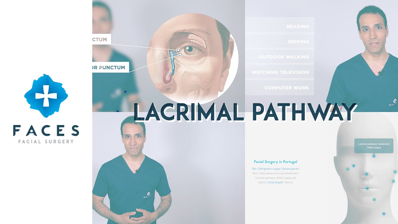 Tears, watery eyes and lacrimal pathway infection - YouTube