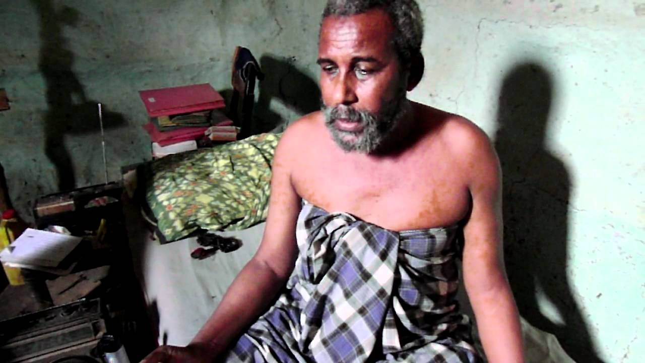 Africa: The Poor Disabled in Somalia - YouTube